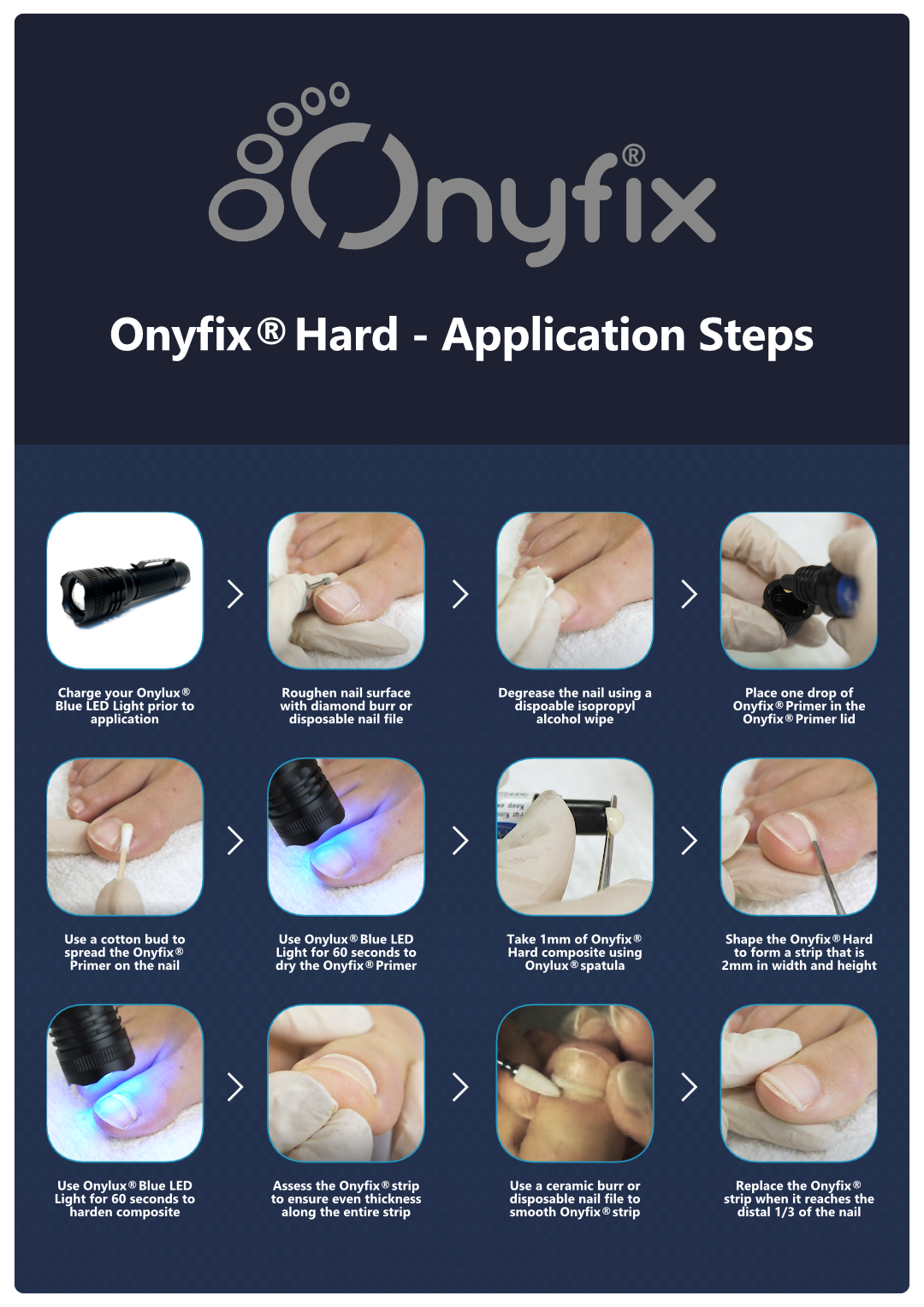 Onyfix®️ Tips & Tricks